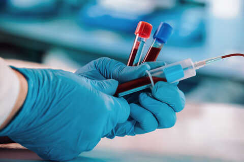 Hematology | North Carolina | UNC Health
