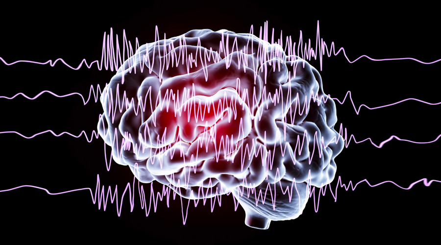 Brain & Nervous System | UNC Health